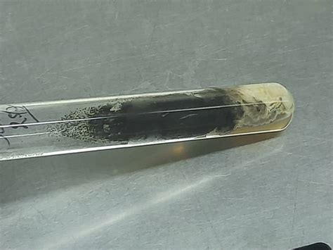 Aspergillosis Guidelines 2021 Archives Medical Notes