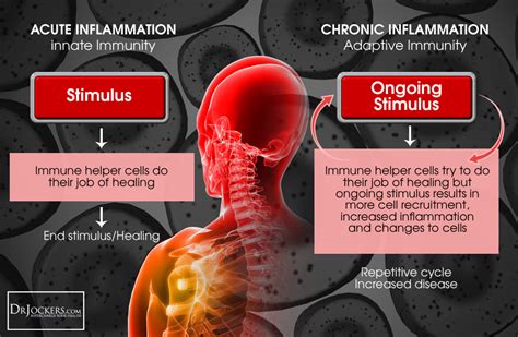 5 Ways To Reduce Inflammation Quickly