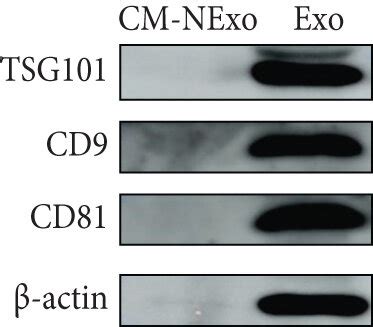 Characterization Of ADSCs And ADSC Exos A Adipogenic Differentiation