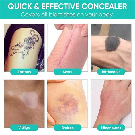 Ultra Thin Patch For Tattoo Scar And Birthmarks Tattoo Cover Up Tape Invisible Waterproof Skin