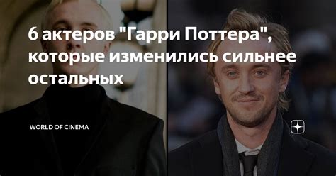 6 актеров Гарри Поттера которые изменились сильнее остальных World