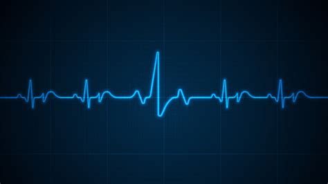 Съмнения за смърт след лекарска грешка Изписаха лекарства за настинка на жена с инфаркт