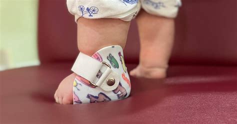 Paediatric Afo East Coast Podiatry Singapore