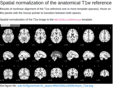 3 pre processing and qa hoplab wiki