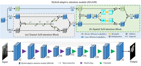 GitHub CGPxy AAU Net AAU Net An Adaptive Attention U Net For Breast Lesions Segmentation In