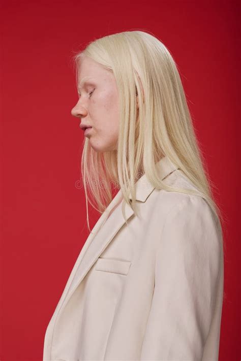 Albino Young Girl With White Hair Stock Image Image Of Sensitive