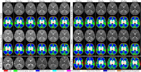 2021 Generative Adversarial Registration For Improved Conditional Deformable Templates