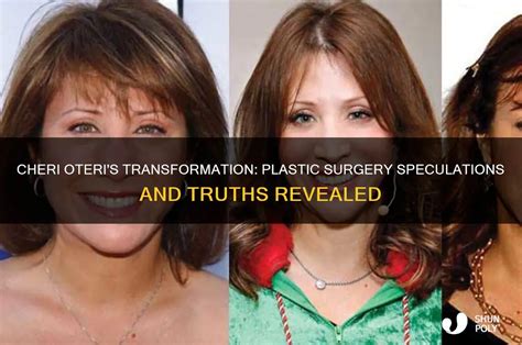 Cheri Oteris Transformation Plastic Surgery Speculations And Truths