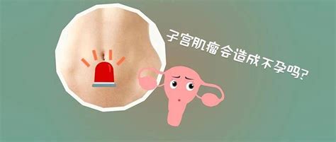 子宫肌瘤会造成不孕吗？可不可以生孩子？女性
