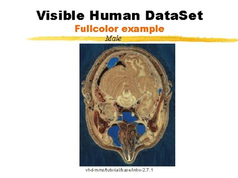 Visible Human Dataset