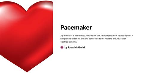 Pacemaker