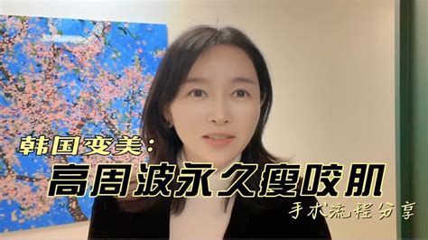 韩国高周波永久瘦咬肌 全程清醒的状态下也能轻松变美 Youtube