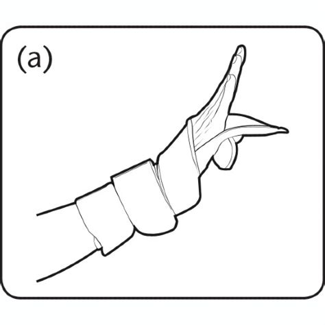 Extensor Tendonitis Exercises Nhs At Amanda Snyder Blog