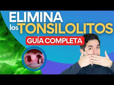 Como Eliminar Bolitas Blancas De La Garganta Unisalia