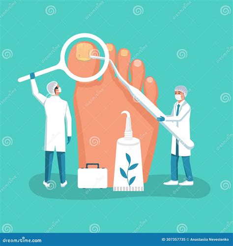 Nail Disease Onychomycosis Concept Fungal Nail Infection Vector