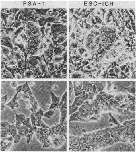 Teratocarcinoma Semantic Scholar