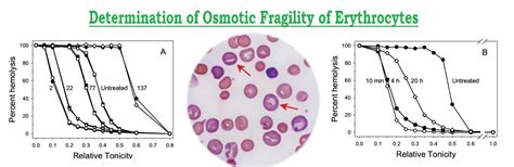 Principle Of Osmotic Fragility Test Archives Medicoinfo