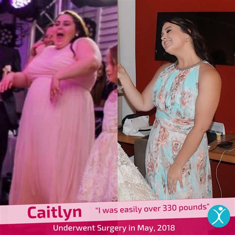 Meet Our Patient Of The Day Mexico Bariatric Center
