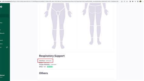 Rename Unknown To None For Interface In Respiratory Support Section View Details Of Log