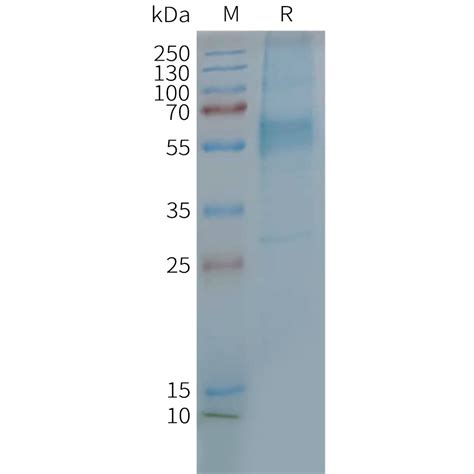 Human Gipr Full Length Protein Neweast Biosciences Gtpase Oncogene