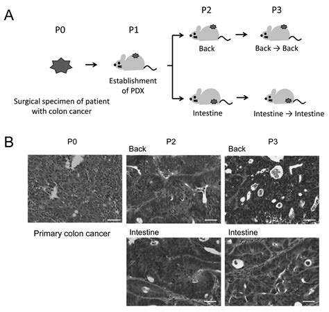 Effect Of Xenotransplantation Site On MicroRNA Expression Of Human Colon Cancer Stem Cells