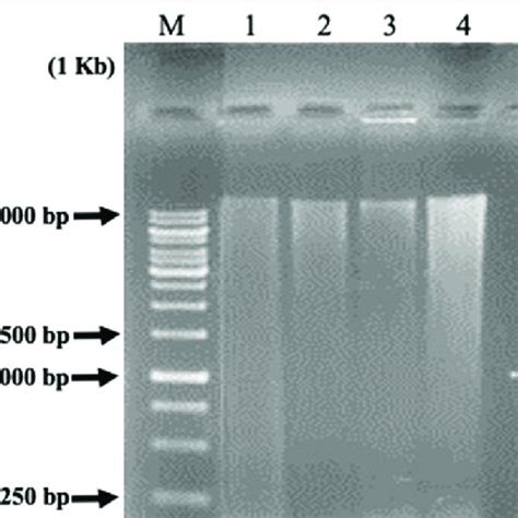 Gram Staining Results Of Four Lactic Acid Bacteria 1000× Cellulolytic