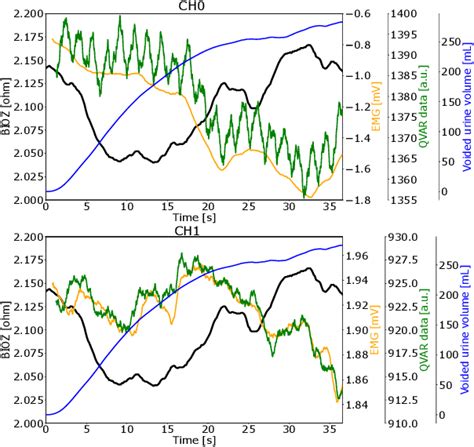 Figure 4 From Towards Enhanced Bladder Volume Measurement With Context