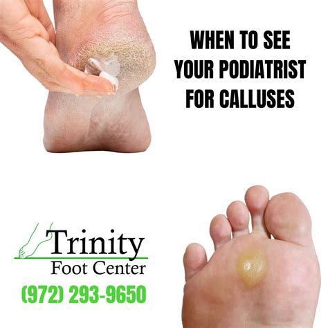 Calluses Can Appear Wherever There Trinity Foot Center Facebook