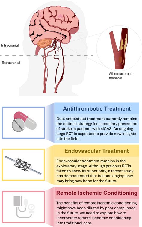Secondary Prevention For Intracranial Atherosclerotic Stenosis Where