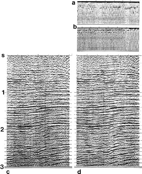 Mathematical Foundation Of Deconvolution Seg Wiki