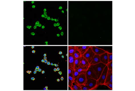 Tfeb E4i8r Mouse Mab Cell Signaling Technology