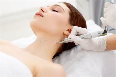 Cosmetologist Removing Mole With Laser Machine Stock Image Image Of
