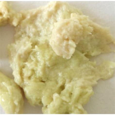 Panel With The Eight Stool Photographs Shown To Participants Download