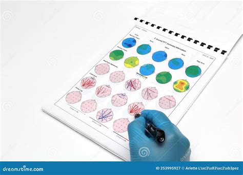 Brain Mapping Done By A Neurologist Doctor With Neuroscience Technique Done Cartography Spatial