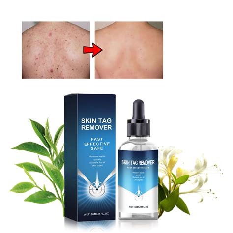 Diuryce Lightweight Moisturizer Skin Care For Dry Skins Essence Water