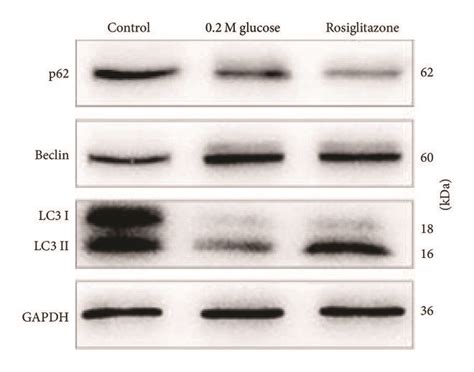 Western Blot Analysis Showed An Increased Expression Of Beclin 1 And