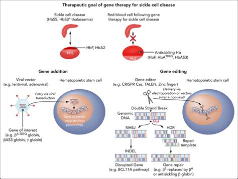 Gene Therapy For Sickle Cell Disease Moving From The Bench To The