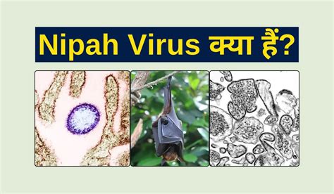 निपाह वायरस क्या है Nipah Virus Kya Hai Symptoms Transmission और बचाव के उपाय Hindiastar