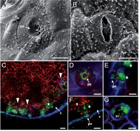 Immunity At Hydathodes Controls Bacterial Infection Plantae