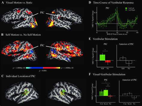 Activation Of Area Posterior Insular Cortex Pic During Visual Motion Download Scientific