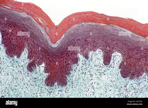 Uterus Light Micrograph Of A Section Through The Ectocervix Region Of The Uterine Cervix The
