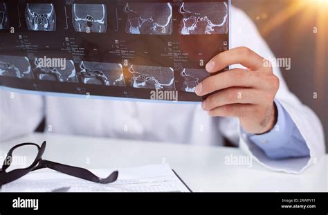 Human Head Mri Brain Scan What Do They Look For Hi Res Stock