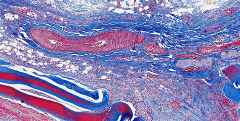 Pixel Classification To Object Detection Image Analysis Imagesc Forum