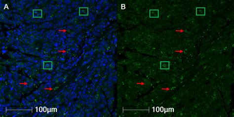 Improving Multiplex If Image Analysis Workflows Does The Perfect Solution To Autofluorescence