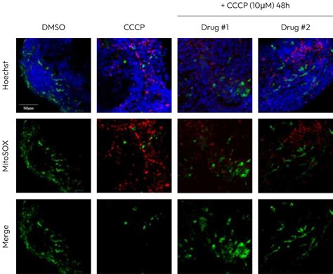 Midbrain Organoids Lambda Biologics