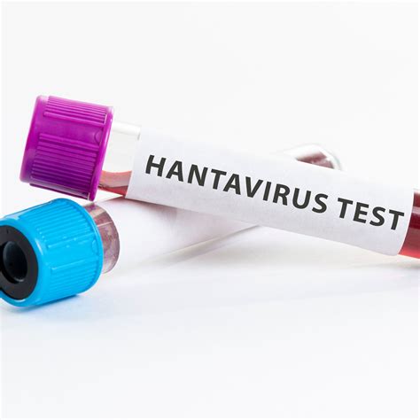 Hantavirus Frequenz