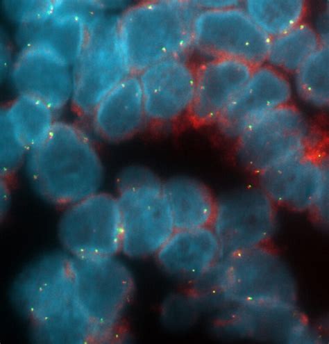 ROS1 Analyte ControlDR HistoCyte