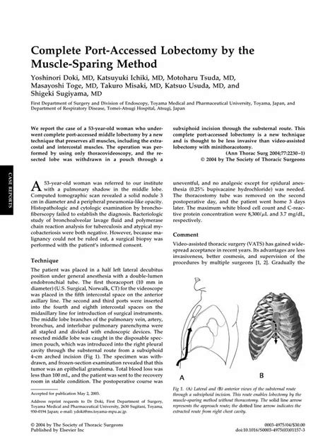 Pdf Complete Port Accessed Lobectomy By The Muscle Sparing Method Dokumen Tips