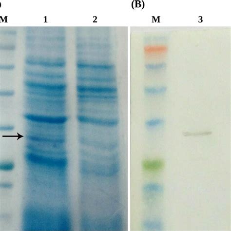Evaluation Of The Recombinant Netb Antigen Expression By L Casei