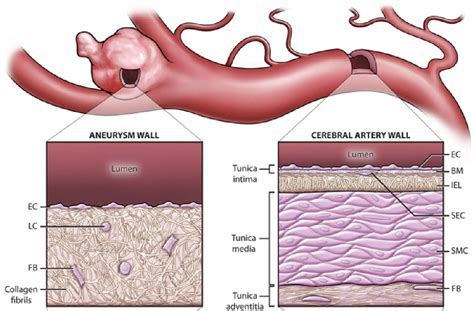 Figure 11 From A Novel Fluid Solid Growth Transport Framework For Modelling The Evolution Of